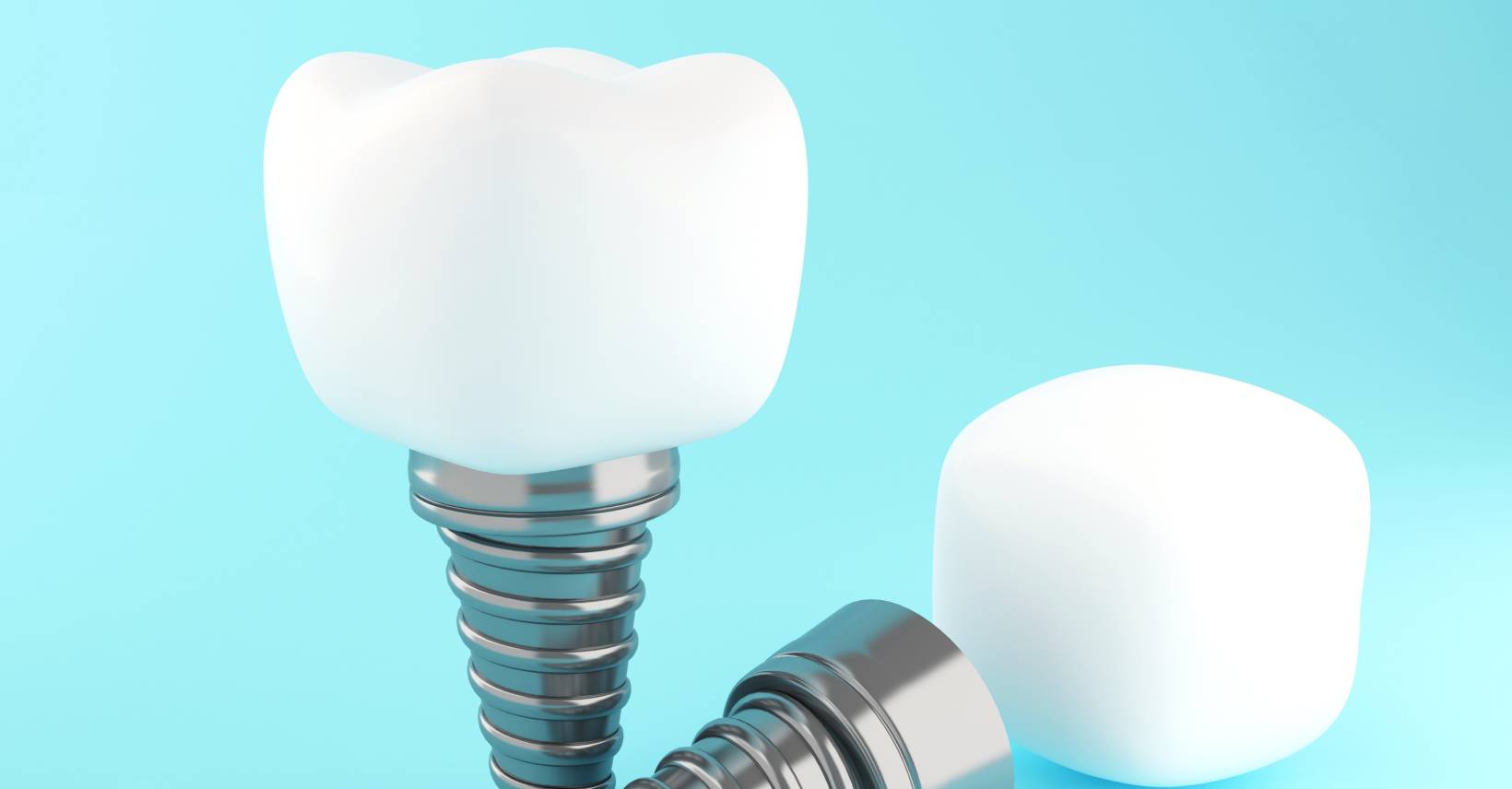 Protesi fissa su impianti Reggio di Calabria - C Dental Rc